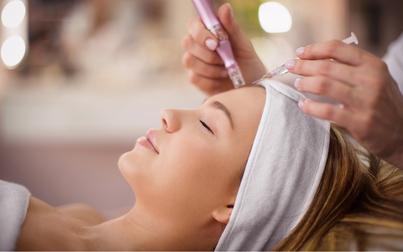 Những điều cần biết về phương pháp vi kim da mặt - Saostar.vn