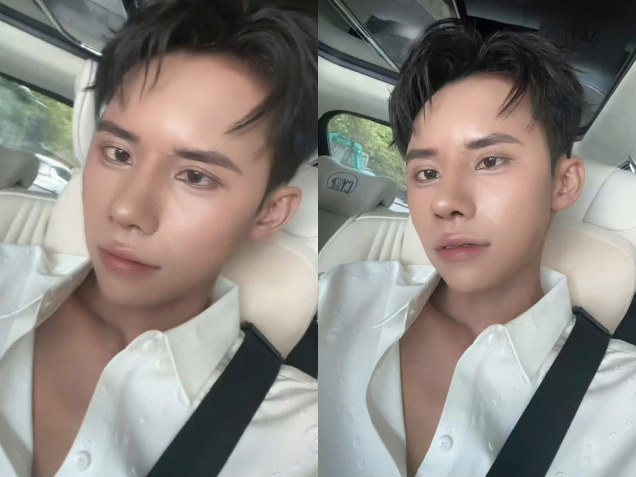 Nhan sắc thăng hạng ngỡ ngàng của Lai Thai khi 'dao kéo' ở Việt Nam ...