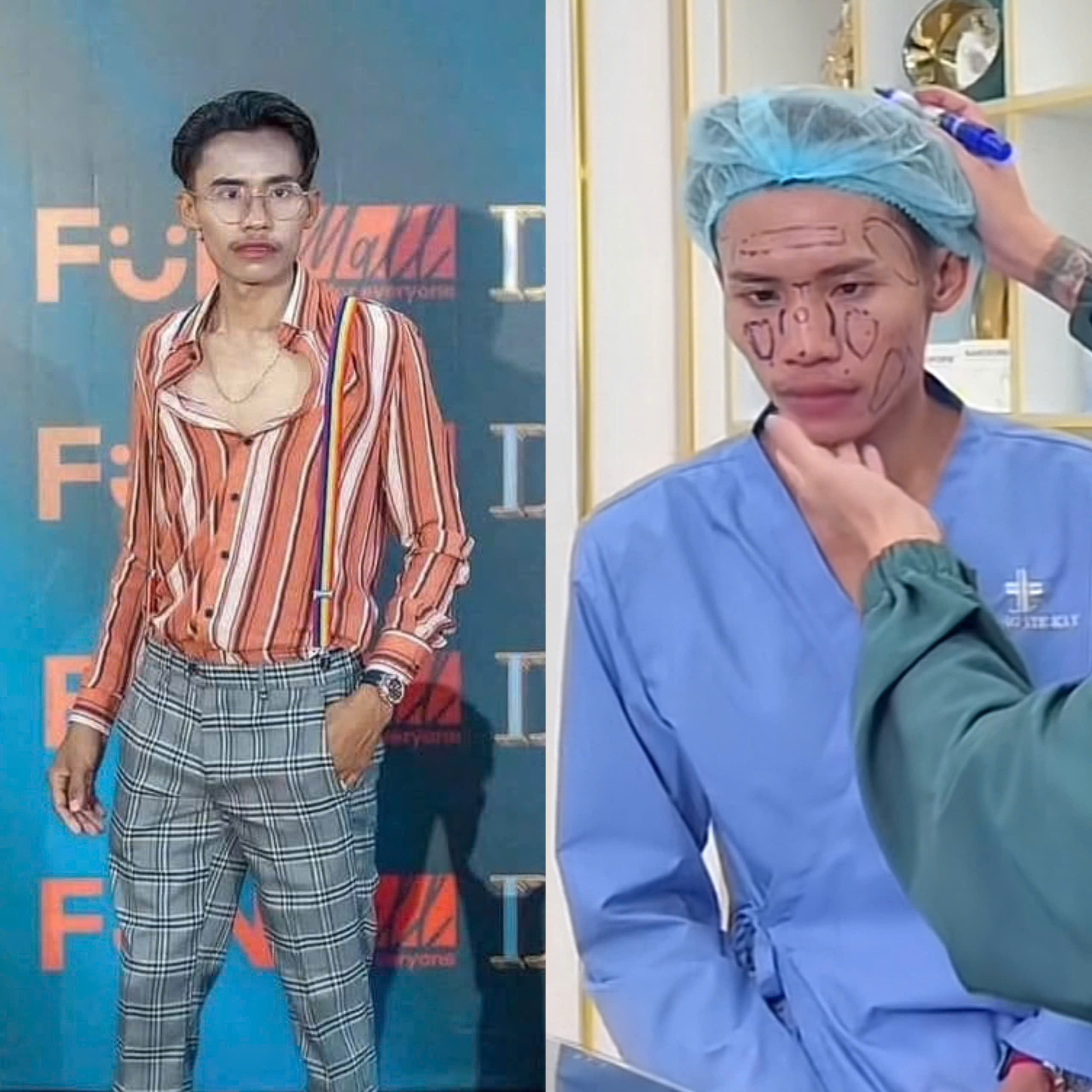 Lai Thai bật khóc khi được phẫu thuật thẩm mỹ ở Việt Nam - Saostar.vn