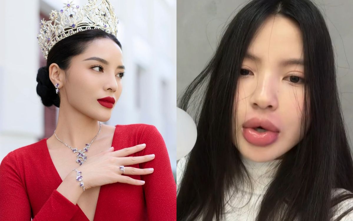 Hoa hậu Kỳ Duyên, vợ Quang Hải làm đẹp như nhau, vì sao kết quả khác? - Saostar.vn
