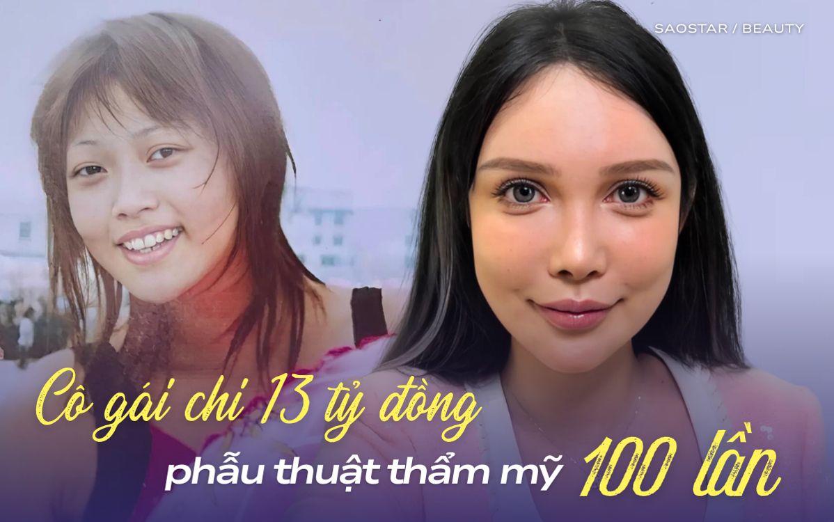 Người phụ nữ chi 13 tỷ phẫu thuật thẩm mỹ 100 lần vẫn chưa thỏa mãn ...