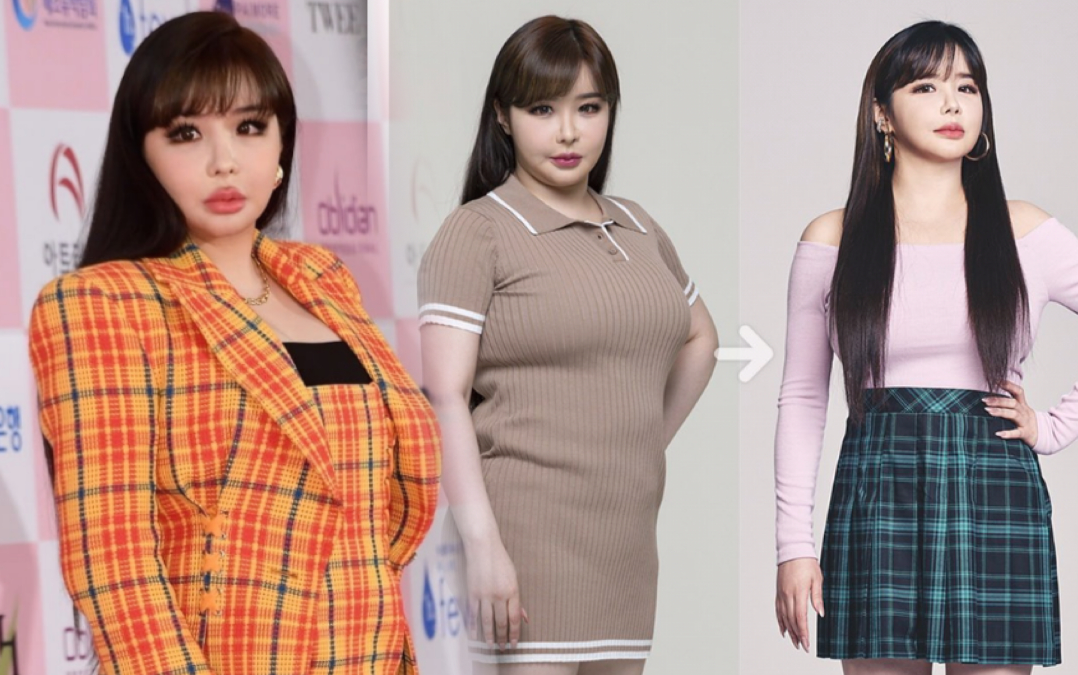 Park Bom (2NE1) lột xác sau khi giảm 11kg: Mặt vẫn đơ như búp bê bị hỏ - Saostar.vn